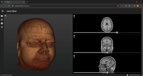 GitHub KitwareMedical Trame Slicer Bring The Capabilities Of D Slicer To The Web With Modern