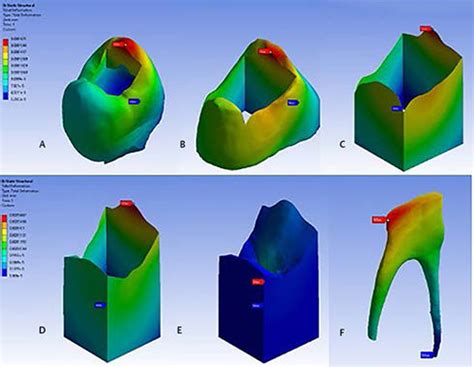 Stress Distribution From Finite Element Analysis Of Three Dimensional