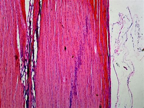 Muscle Tendon Junction Mammalian Longitudinal Section Hande Stain By
