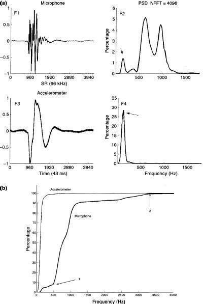 This Figure Illustrates The Differences In The Distribution Of Energy
