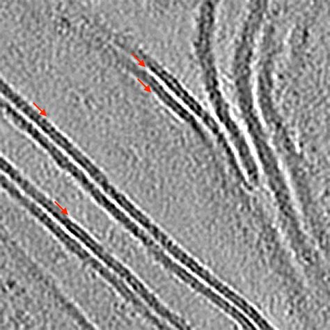 White Density Around The Denoised Membrane · Issue 32 · Juglab Cryocare Pip · Github