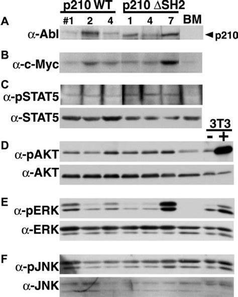 No Qualitative Defect In Activation Of Signaling Pathways In Primary