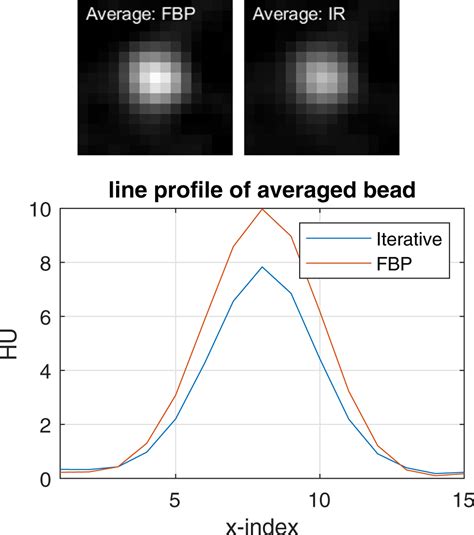 Rapid Measurement Of The Low Contrast Detectability Of Ct Scanners Pmc