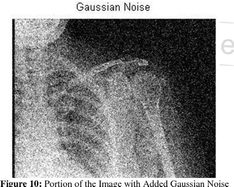 Figure 10 From Augmentation Of X Rays Images Using Pixel Intensity Values Adjustments Semantic