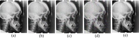 Different Type Of Noises A Gaussian Noise Variance 001 B Download Scientific Diagram