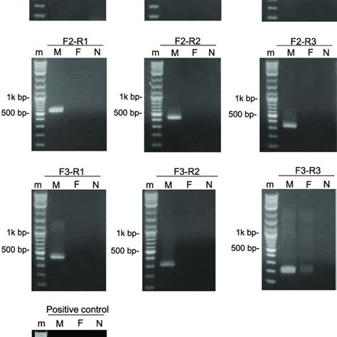 Sex Identification Using FSDM Download Scientific Diagram