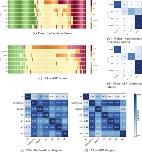 Attention Based Whole Slide Image Compression Achieves Pathologist