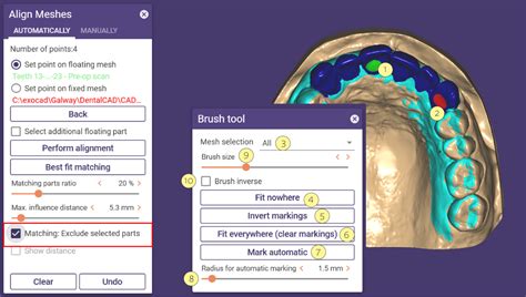 Align Meshes Exocad