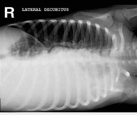 Plain Chest X Ray Right Lateral Decubitus View Showing A Large Free Download Scientific