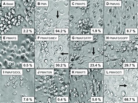 Alteration Of The Morphology Of Pma Differentiated Thp 1 Cells By