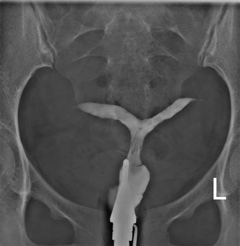 Image Radiopaedia Org