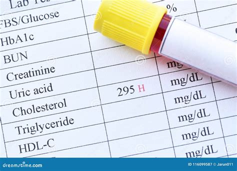 Abnormal High Cholesterol Test Result Stock Image Image Of Hyperlipidemia Care