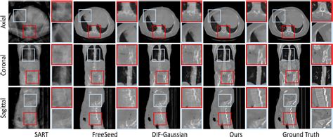 X Grm Large Gaussian Reconstruction Model For Sparse View X Rays To Computed Tomography