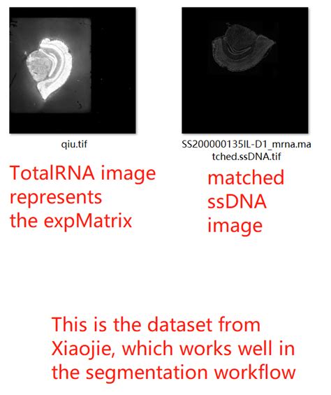 Issues When Running The Refactor Segmentation Code Issue Aristoteleo Spateo Release GitHub