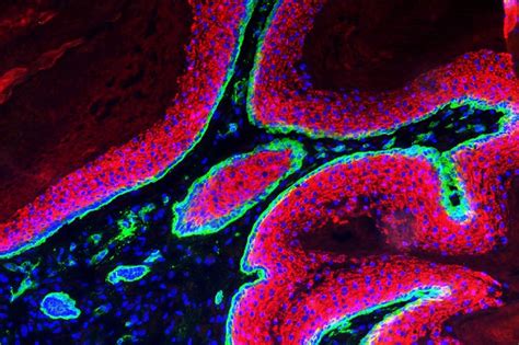 Four Ucla Stem Cell Researchers Awarded 12 Million In Grants To Translate Basic Discoveries