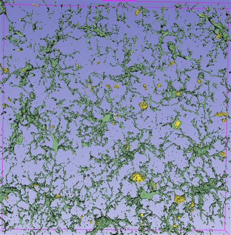 Logical Operators Intersect Function Causes Selected Segment To Disappear Support 3d Slicer