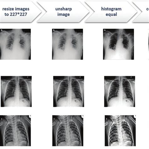 The Sequence Of Processing Operations Applied To The Dataset Download Scientific Diagram