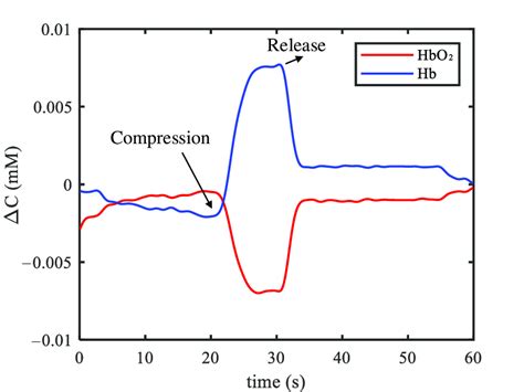 Example Of Results In The Forearm Arterial Occlusion Experiment