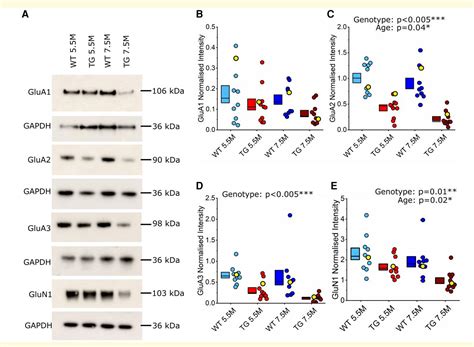 Figure 2 From Synaptic Alterations Associated With Disrupted Sensory Encoding In A Mouse Model