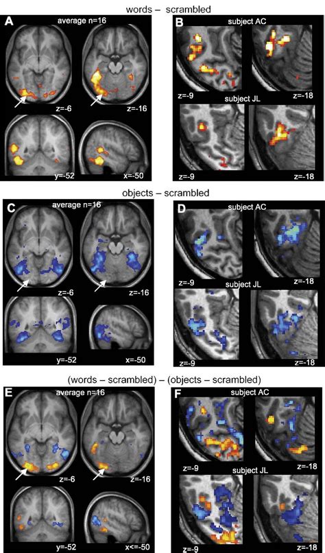 Figure 2 From Specialization For Written Words Over Objects In The Visual Cortex High Level