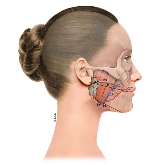 Masseter Botox