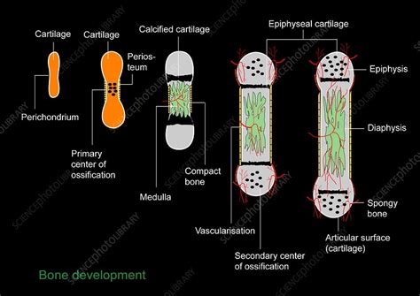 Bone Growth Artwork Stock Image C0097940 Science Photo Library