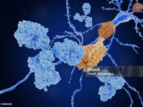 알츠하이머 병의 면역 요법 아밀로이드 베타 피브릴에 결합하는 항체 아밀로이드에 대한 스톡 사진 및 기타 이미지 아밀로이드 항체 뇌 Istock