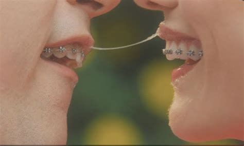 Greener Grass Kiss Can You Kiss With Braces Kelly Green Braces