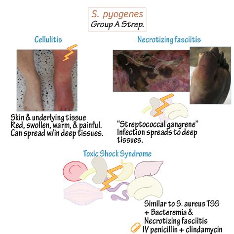 Immunology Microbiology Glossary Streptococcus Pyogenes Ditki Medical And Biological Sciences