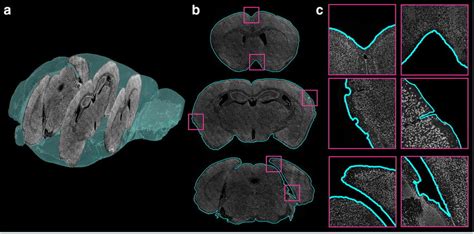 The Outline Segmentation Of Mouse Brain Images A The 3d Reconstruction