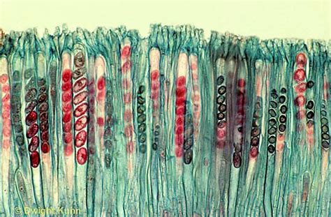 Fungi Under A Microscope