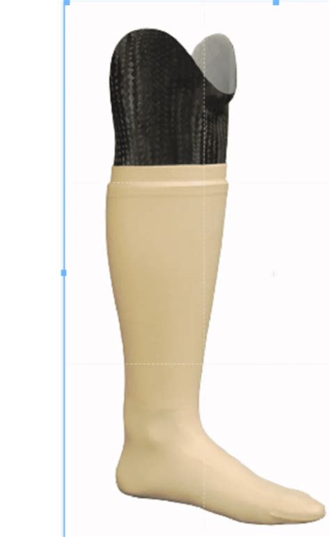 Below Knee Prosthesis Functional Prosthetic At ₹ 40000 In Hyderabad