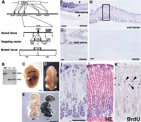 Causal Relationship Between The Loss Of Runx3 Expression And Gastric