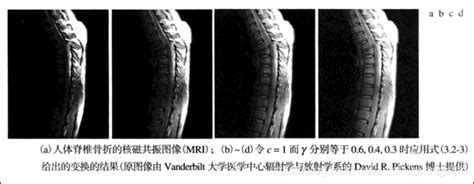 数字图像处理 18 图像灰度变换——线性灰度变换 和 非线性灰度变换 对数变换 与 伽马变换 线性灰度级变换 csdn博客