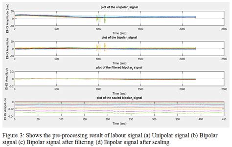 Analysis Of Unipolar And Bipolar 4×4 Ehg Signal For Classifying Uterine