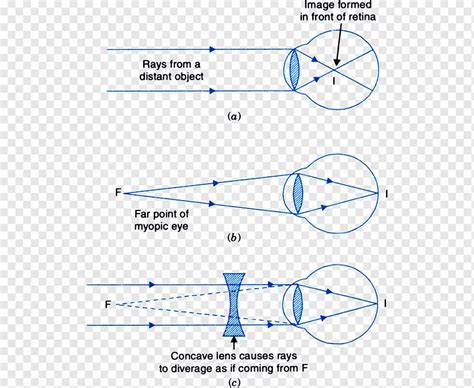 The Ultimate Guide To Human Eye Ray Diagram Moo Wiring