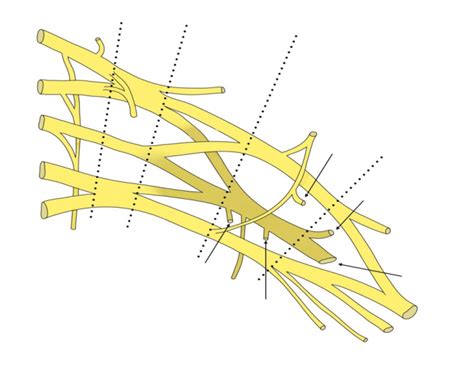 Brachial Plexus Labeling — Udskrivbart Arbejdsark