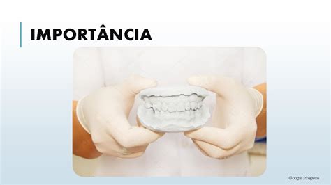 Gessos Odontolgicos Faculdade De Odontologia De Ribeiro Preto