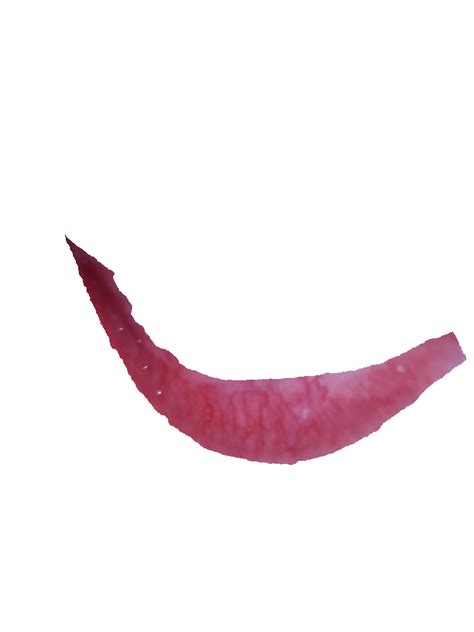 Deteksi Anemia Object Detection Dataset By Skripsi Anemia