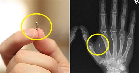 손에 ‘마이크로칩 심어 사원증 대신하는 회사직원 사생활 감시 논란 인사이트