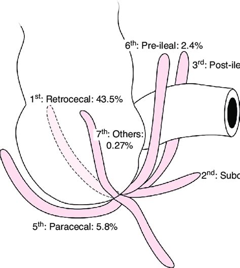 Appendix Anatomy Wikipedia 50 Off
