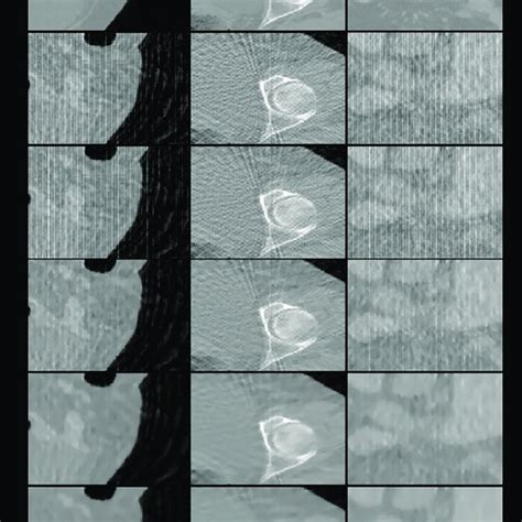Procedure Of Compressed Sensing Based Reconstruction Algorithm Using Download Scientific