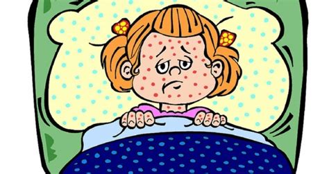 Улаанбурхан өвчний талаар асуудаг түгээмэл асуултууд Мэдээ мэдээлэл Монголын иргэн бүрд