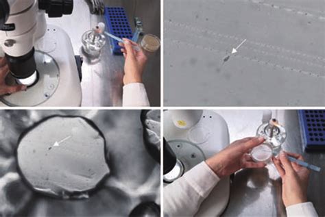 Isolation Of A Single Pyricularia Oryzae Spore A Sterilize A