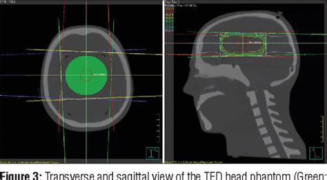 Figure 1 From Investigation Of Computed Tomography Numbers On Multiple Imaging Systems Using