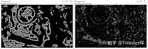 Imagej实用技巧——免疫组化分析 定量分析篇 知乎