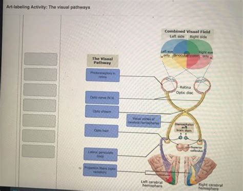Solved Art Labeling Activity The Visual Pathways Combined Visual Field 1 Answer