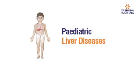 Paediatric Liver Diseases Causes Symptoms Diagnosis And Treatment