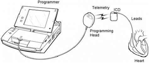 Pacing And Defibrillation Thoracic Key