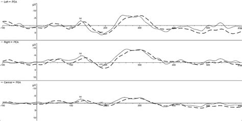 Example Of Olfactory Event Related Potentials Oerps Comparison Of